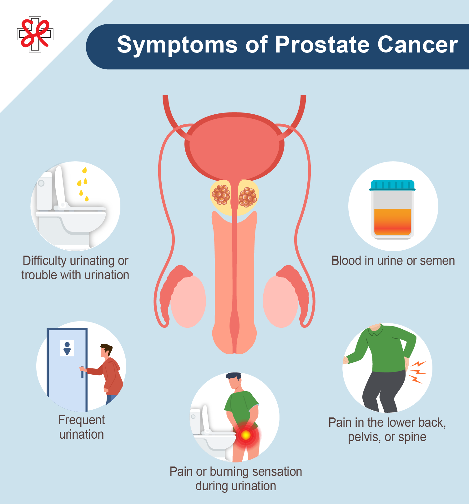 What is Prostate Cancer? Learn more about its Symptoms, Causes, and Treatments. - Health ...